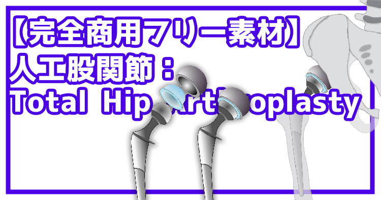 【完全商用フリー素材】自由に動かせる人工股関節（thatota 理学療法士・作業療法士・言語聴覚士の求人、セミナー情報なら【post】